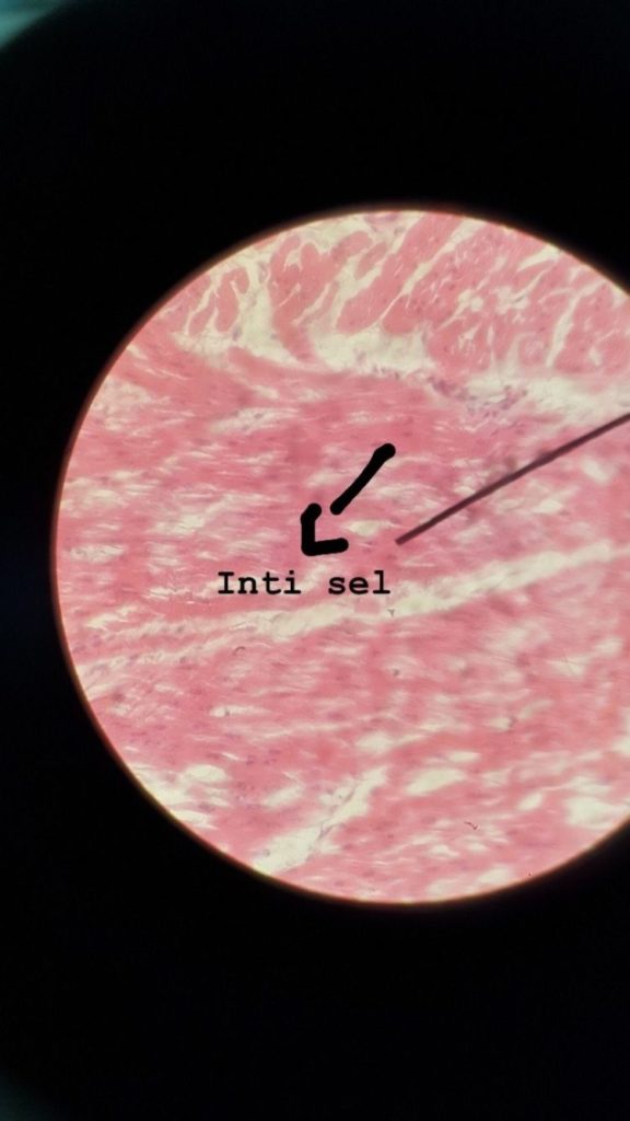 3 Jenis Otot Menurut Mekanisme Kerjanya beserta Fungsinya